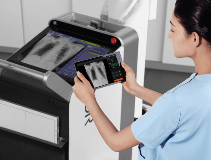 uDR 380i Pro Мобильная система цифровой рентгенографии